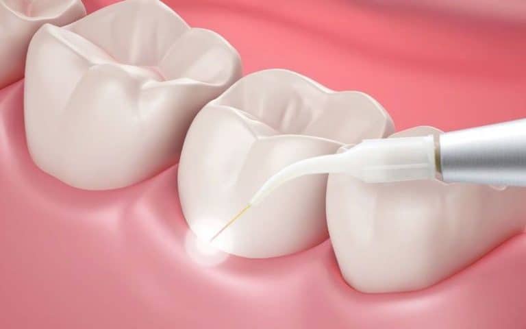 Dental Laser - Diane Bonanni, D.M.D. - Stoneham Family And Cosmetic ...